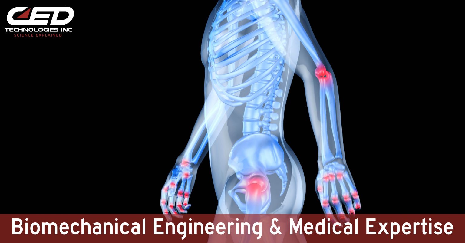 Biomechanical Engineering and Medical Expertise: Working in Conjunction ...